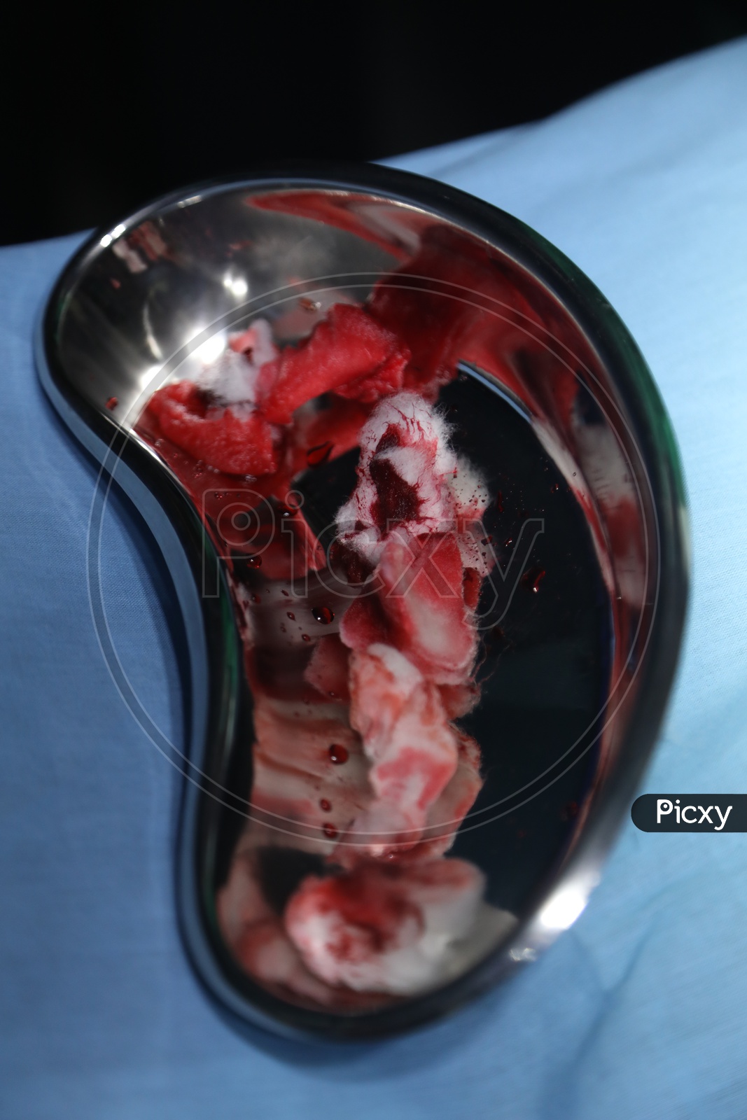 Image of Blood Stained Cotton Balls in a Hospital Tray-FM832152-Picxy