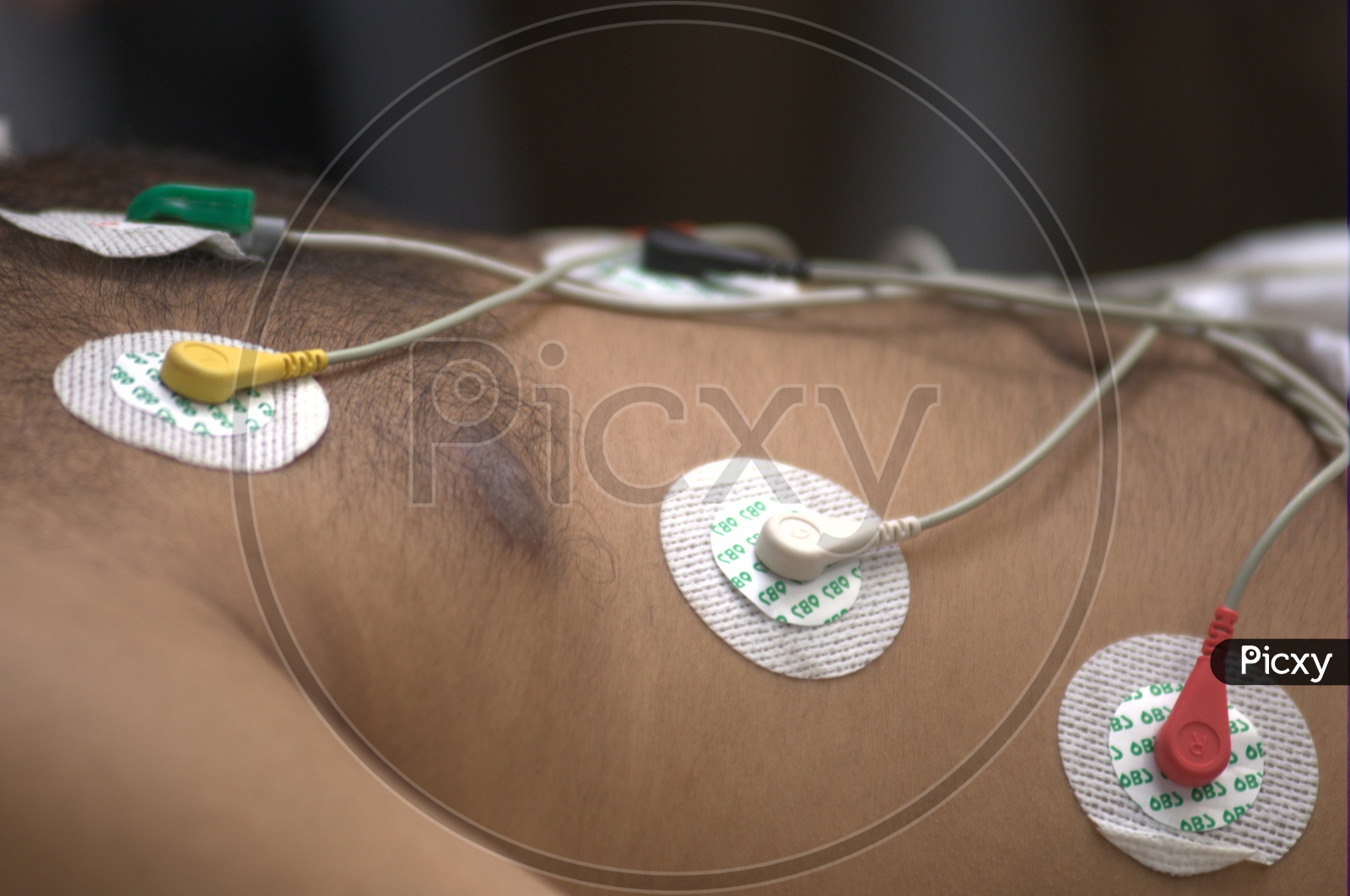 Image of Patient with electrodes on chest-KD124306-Picxy
