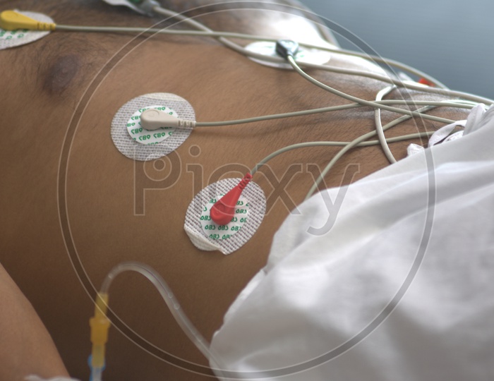 Image of Patient with electrodes on his chest-XU046385-Picxy