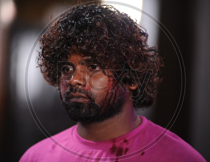 Image of A Man With Blood Stains On Face and Bandage For Head Wounds ...