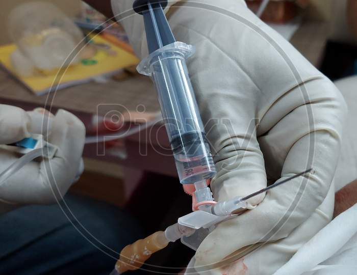 Image of A close up short of two hands of a doctor with an intravenous ...