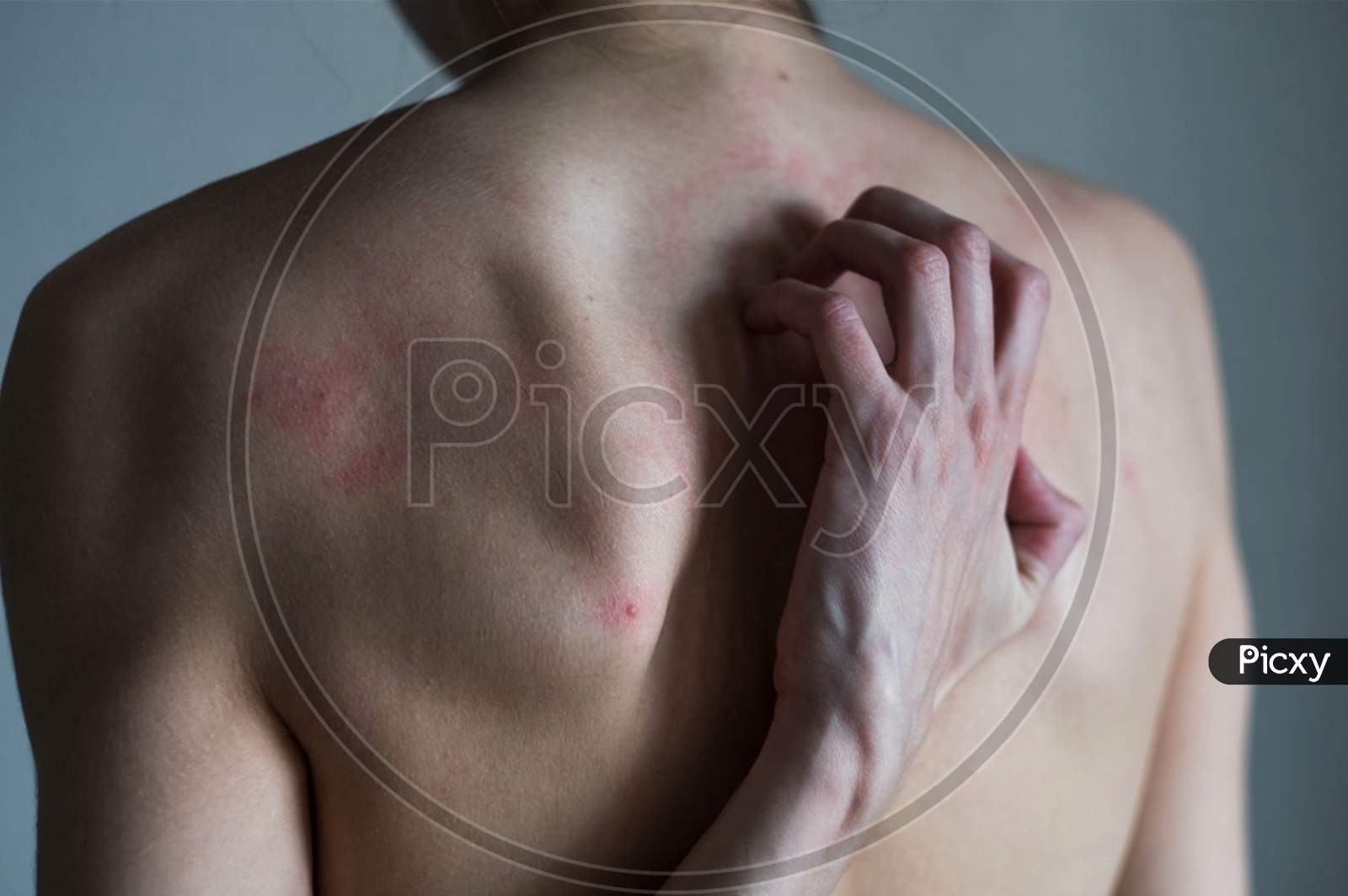 hand scratching back