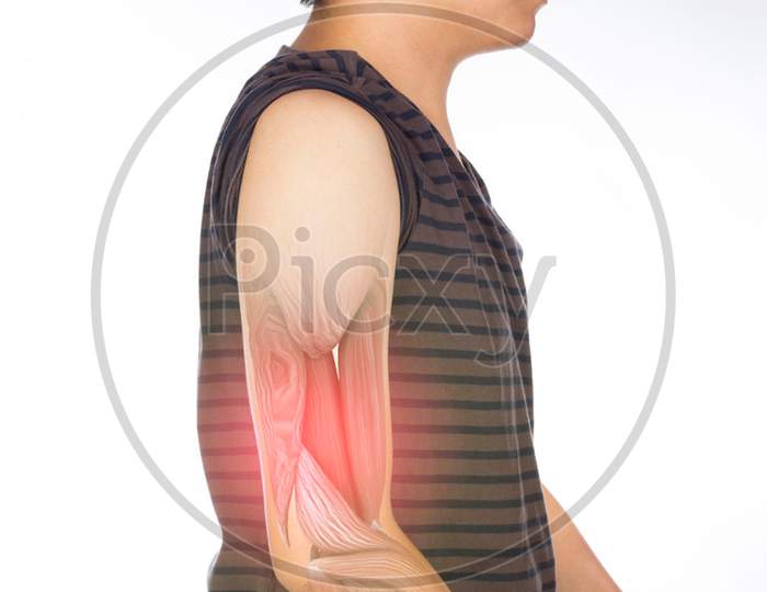Image of arm muscle injury white background arm pain-CP880523-Picxy