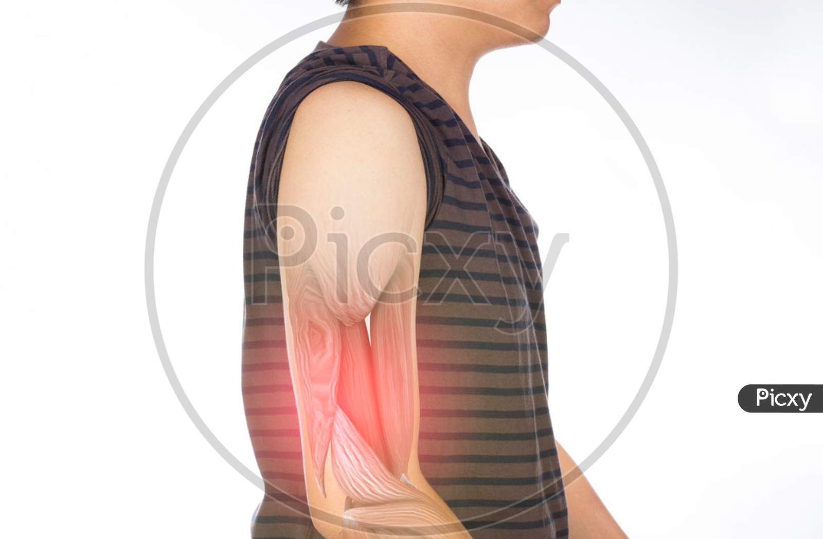 Image of arm muscle injury white background arm pain-CP880523-Picxy