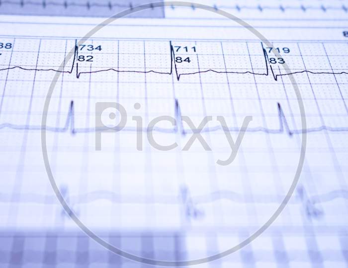 Image of Electrocardiogram Recorded On Graph Paper. Study Of The Human ...