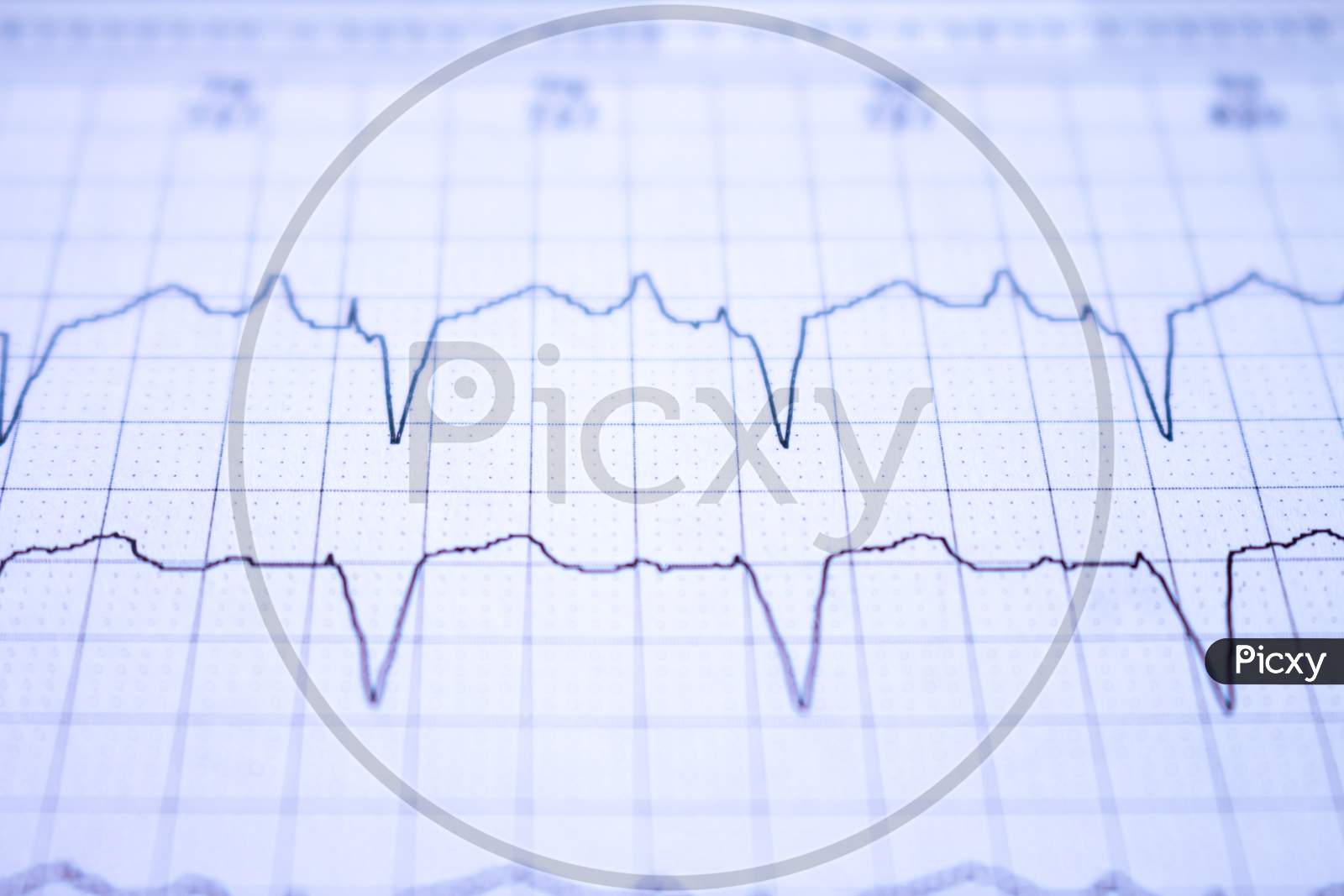 Image of Close-Up Of An Ekg Tracing Of A Patient With A Cardiac ...